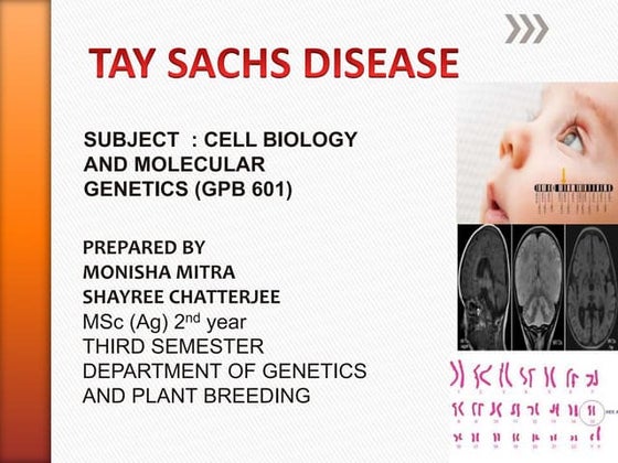 Tay Sachs disease | PPT