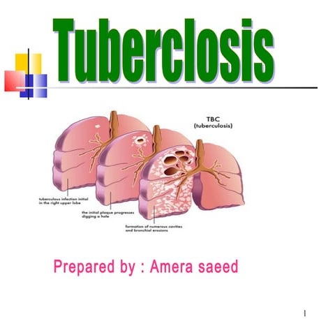 Tuberclosis | PPT