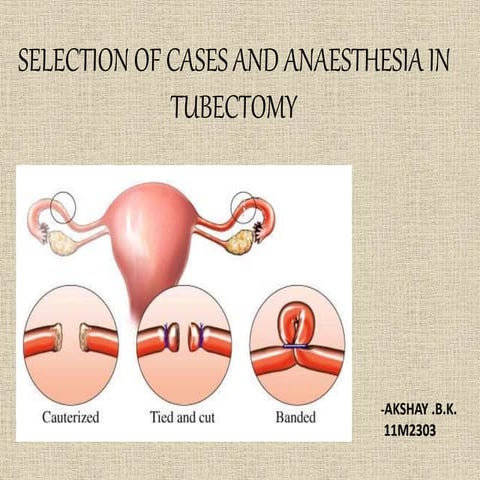 SELECTION OF CASES AND ANAESTHESIA IN TUBECTOMY | PPTX