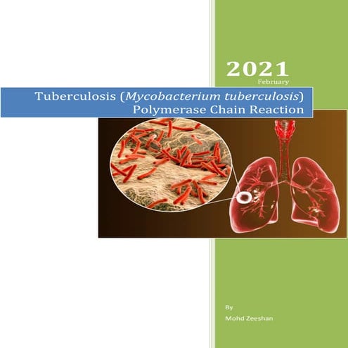 Tuberculosis PCR | PDF