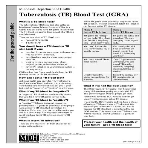 Tb blood test by igra | PDF