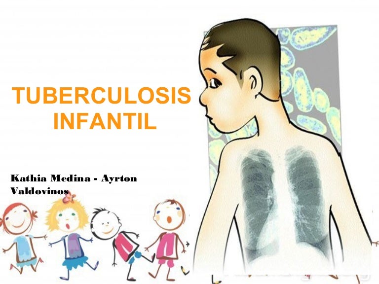 Tbc infantil