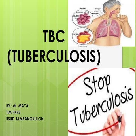 TBC (TUBERCULOSIS) PRESENTASI.pdf