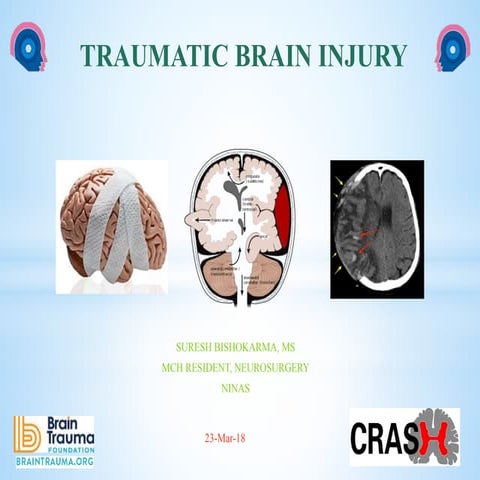 Head Injury AKA Traumatic Brain Injury | PPT