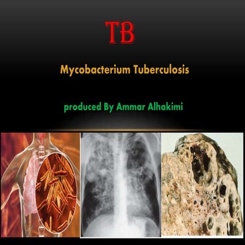 TB infection mycobacterium tuberculosis.pdf