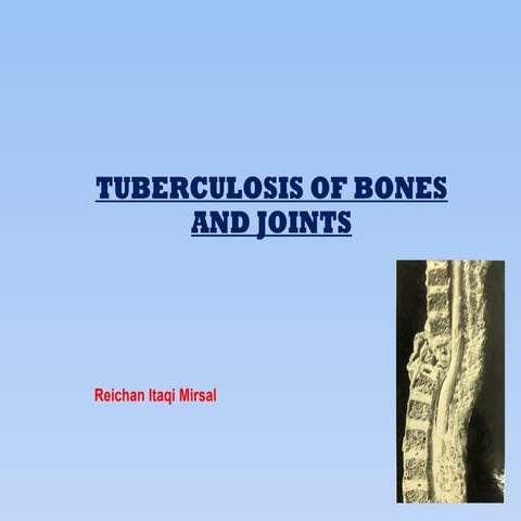 TB Joint & Bones (ppt orthopaedi traumatologi).pptx