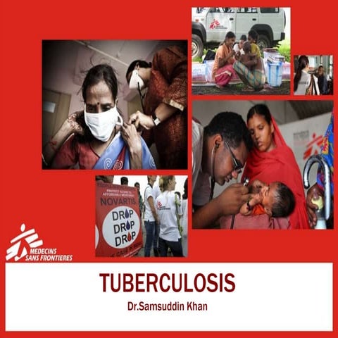 Tuberculosis Basic presentation for general public (Health education) | PPT