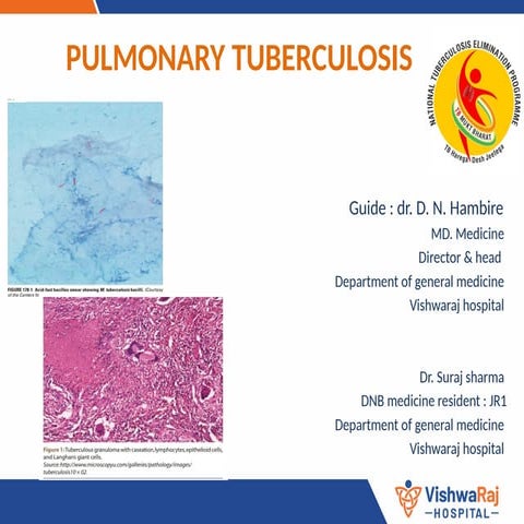 PULMONARY TUBERCULOSIS -PATHO AND MANAGEMENT.pptx