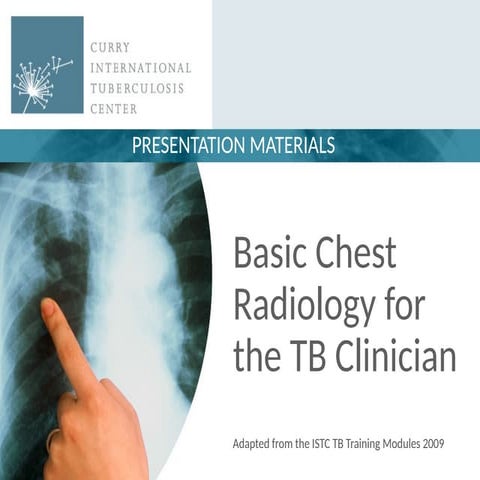 tb_radiology_basic_presentation_slides.pptx