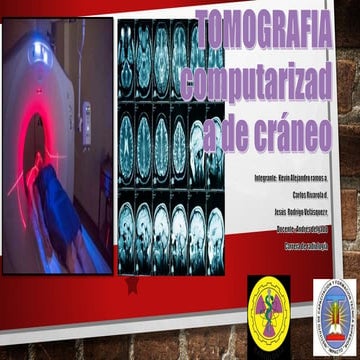 TC DE CRANEO(2).pptx