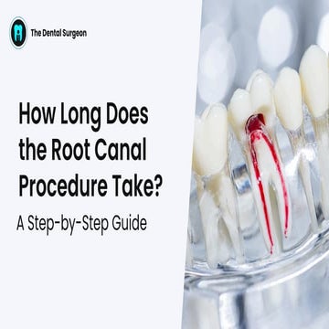 How Long Does a Root Canal Take? A Step-by-Step Patient Guide | PDF