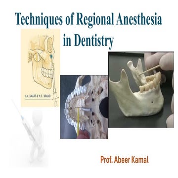 Posterior superior alveolar (psa) nerve block | PPT