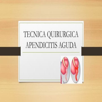 Apendicectomia Tipo Mc Burney | PPTX