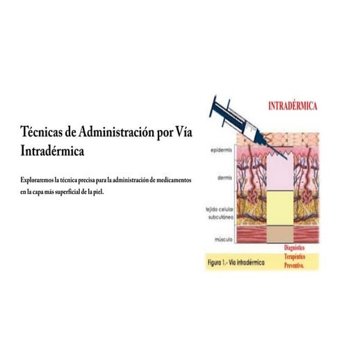 Via intradermica de administracion de farmacos | PPTX