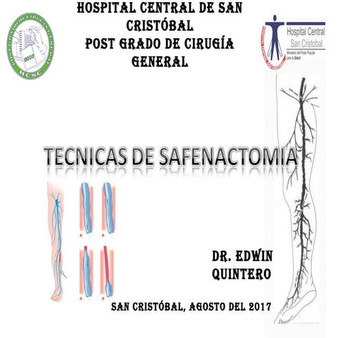 Apendicectomia Tipo Mc Burney | PPTX