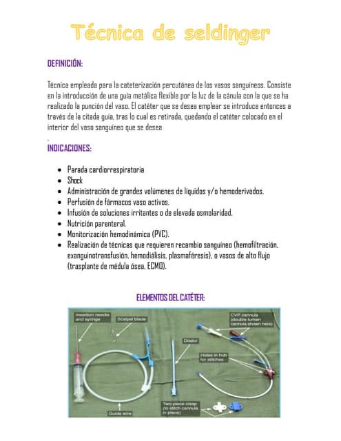 Tecnica de seldinger | PDF