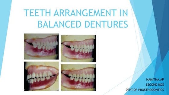 Principles of teeth arrangement and compensatory curves | PPTX