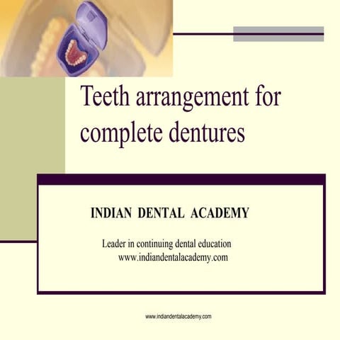Teeth arrangement for complete dentures/ orthodontics courses online | PPT