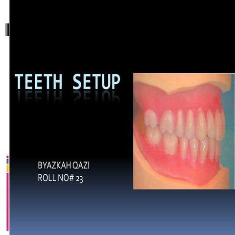 Teeth setup | PPTX