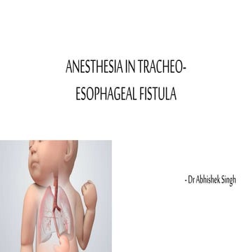 Anesthetic Considerations in Tracheo-esophageal Fistula | PPTX