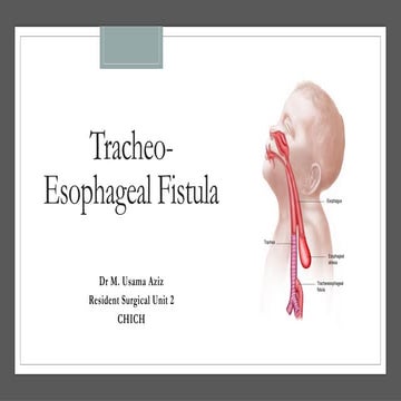 Esophageal Atresia with Tracheo-esophageal Fistula | PPTX