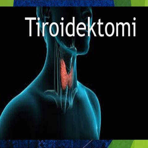 121591453 struma-nodular-non-toksik | DOC