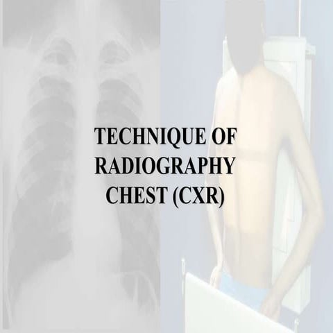 Basic Chest X ray Views - AP, PA & Lateral etc . pptx | PPTX