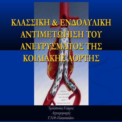 Ανεύρυσματα κοιλιακής αορτής – Ενδαγγειακή Αντιμετώπιση | PPT