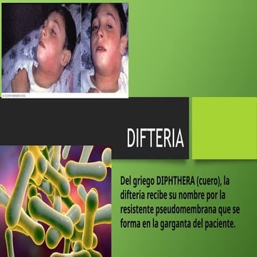 Tema 5 GENERALIDADES DE LA Difteria.pptx
