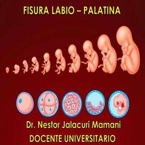 TEMA PRACTICO 11 FISURA LABIO LEPORINO - CLINICA | PDF