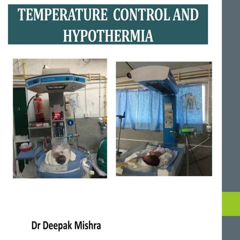 Thermoregulation in newborn | PPTX