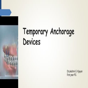 Temporary anchorage devices | PPTX