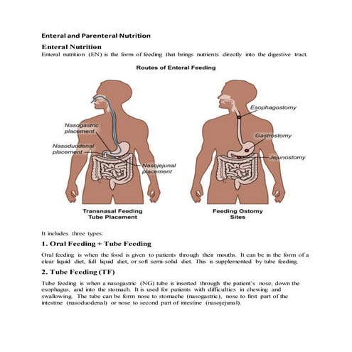 Intermittent bolus feeding versus continuous enteral feeding | PPTX