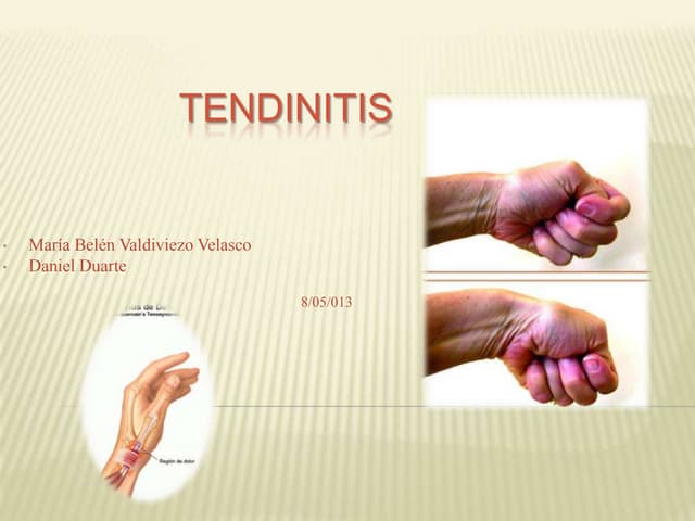 Tendinitis