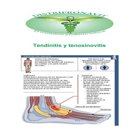 Tendinitis | PDF