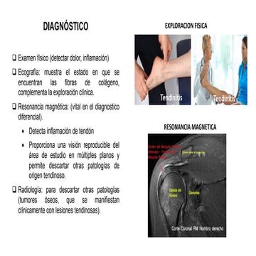 Tendinitis dx tto. (1) | PPTX