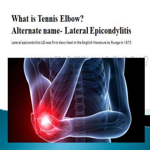Tennis Elbow.pptx