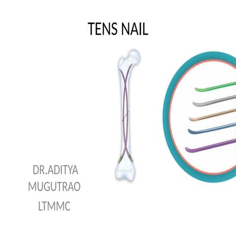 tens nail principles and indications ppt | PPTX
