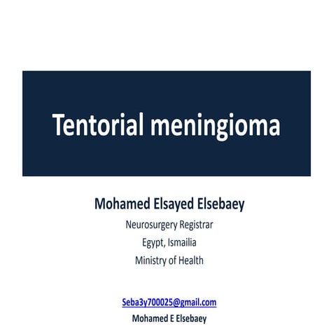 Tentorial meningiomas | PPTX