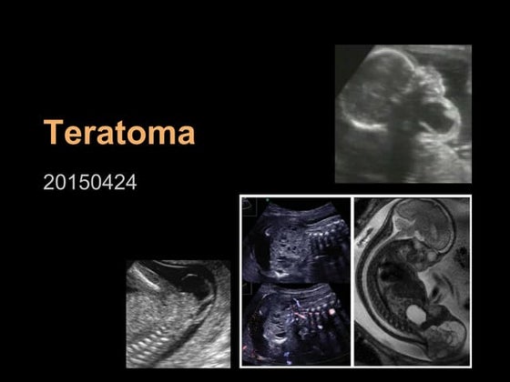 Contracted pelvis (diagnosis and treatment) | DOCX | Pregnancy ...