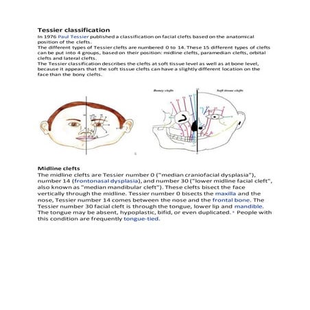 Tessier classification for orthodontist by Almuzian | DOCX