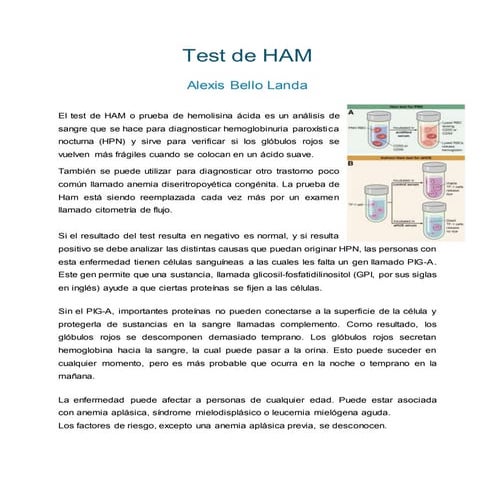 Test de ham alexis bello | DOCX