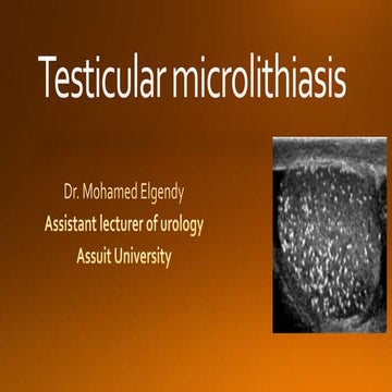 testicular microlithiasis simple.pptx