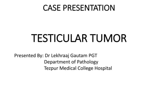 Testicular Tumor Case Presentation Pptx