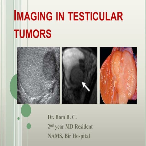 Testicular tumor imaging | PPTX