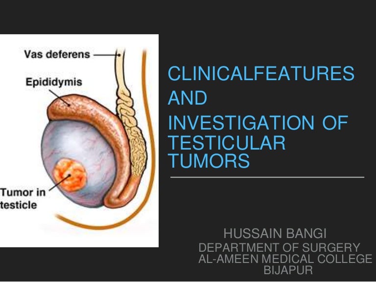 Testicular Tumors