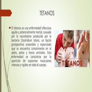 TETANOS , CLASIFICACION, EPIDIMIOLOGIA,TRATAMIENTO | PDF