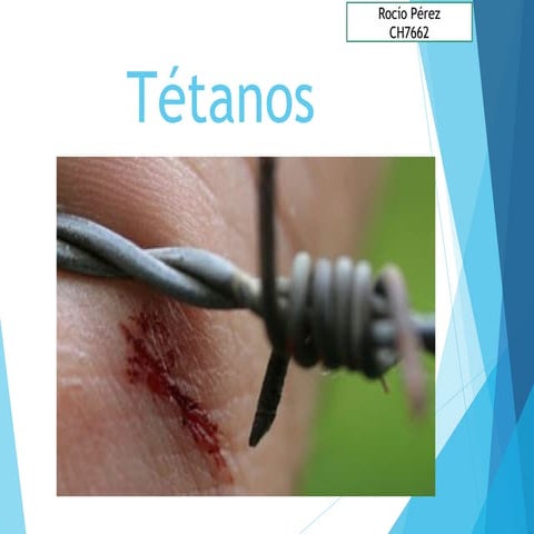 Tétanos | PPT
