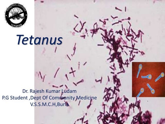Tetanus | PPTX | Infectious Diseases | Diseases and Conditions