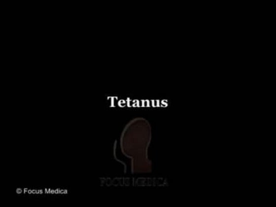 Tetanus | PPT